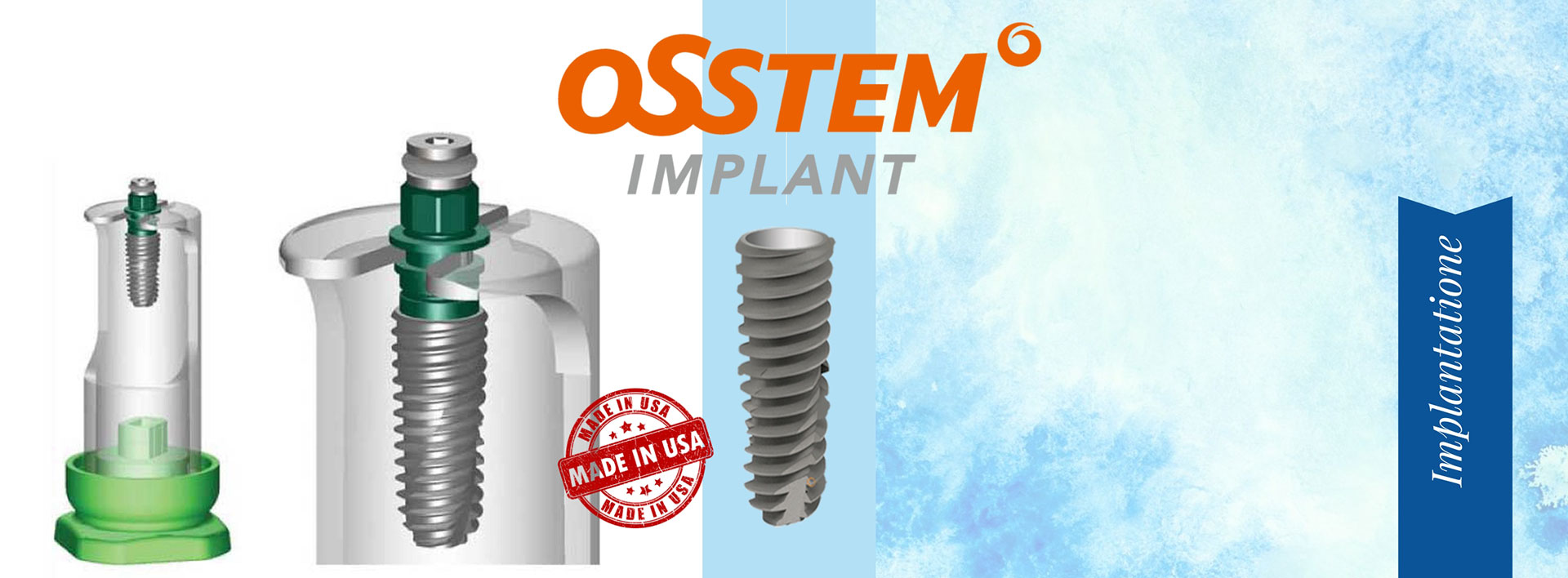 Why do I choose Hiossen implants? – Implant Line